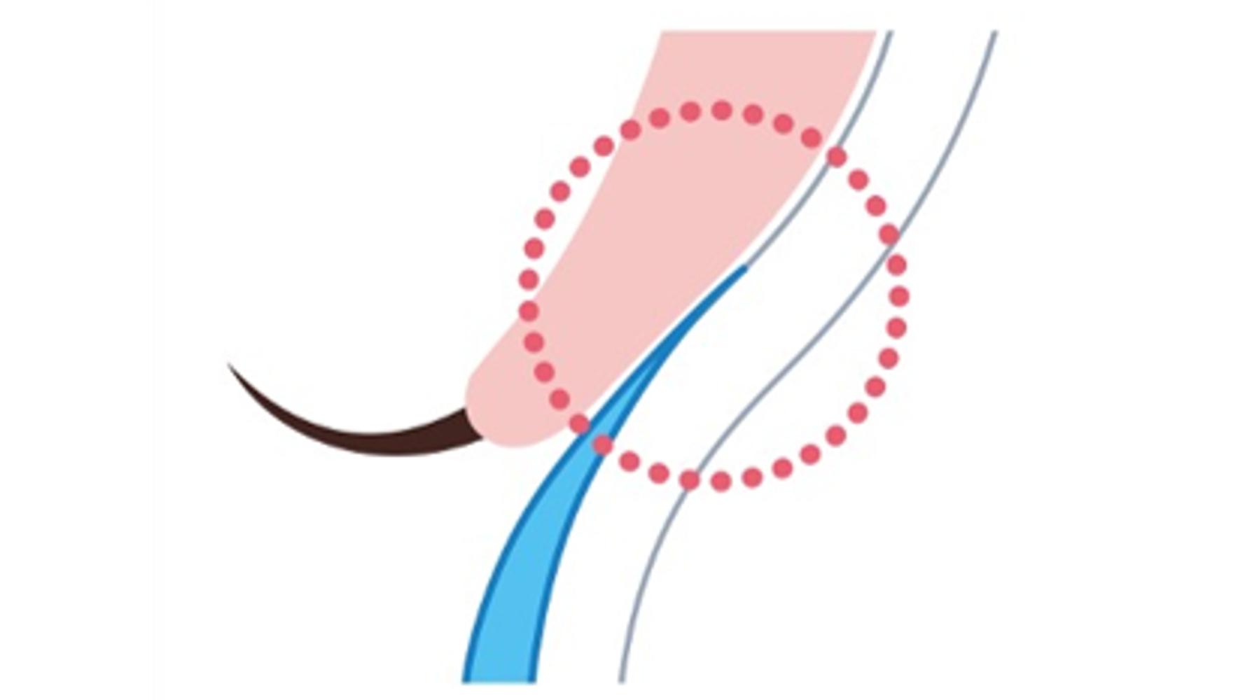 Miru 1day Flat Pack | Products | Professional | Menicon