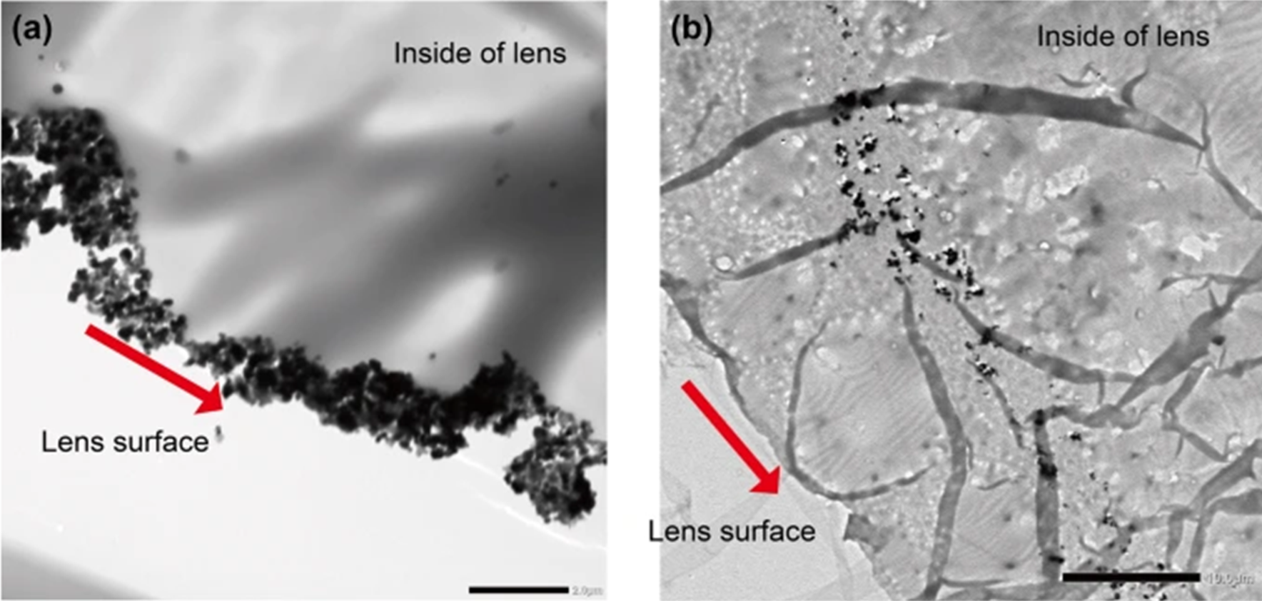 Development of a method for identifying lenses with pigments on the top ...